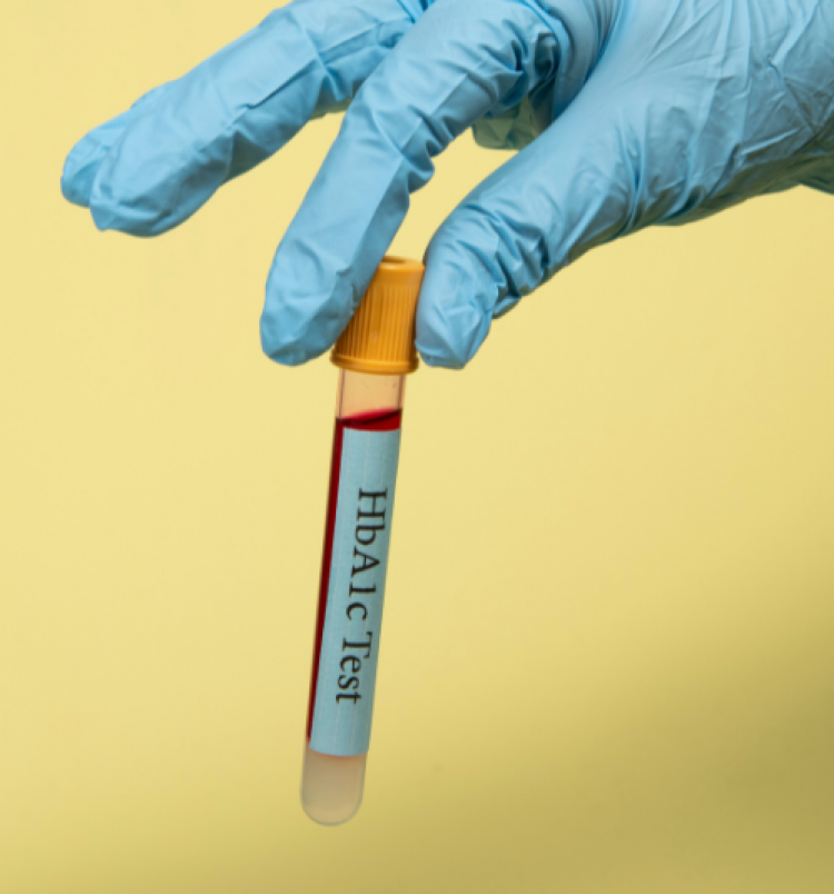 Time-in-Range: De maatstaf voor de bloedglucosecontrole